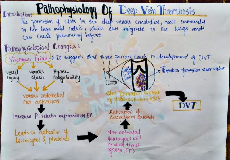 Muhammad Waseem Akram on LinkedIn: Pathophysiology of Deep Vein Thrombosis Muhammad Waseem Akram on LinkedIn: Pathophysiology of Deep Vein Thrombosis