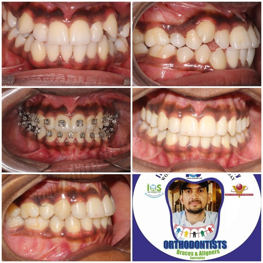Dr Mahipal Singh Chundawat posted on LinkedIn Dr Mahipal Singh Chundawat posted on LinkedIn