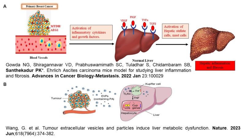 Dr.Prasanna K. Santhekadur on LinkedIn: Two different studies conclude ... Dr.Prasanna K. Santhekadur on LinkedIn: Two different studies conclude ...