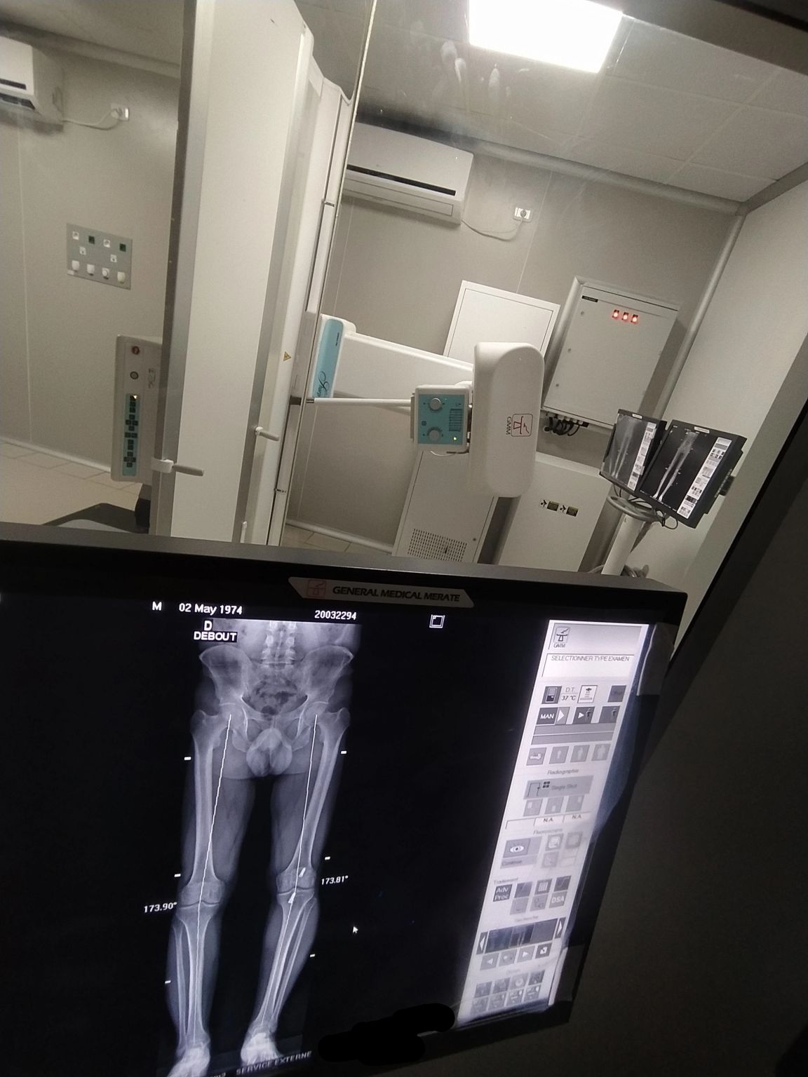 Yamen Ali on LinkedIn: #tiamed #gmm #biomedical #xray #radiology Yamen Ali on LinkedIn: #tiamed #gmm #biomedical #xray #radiology