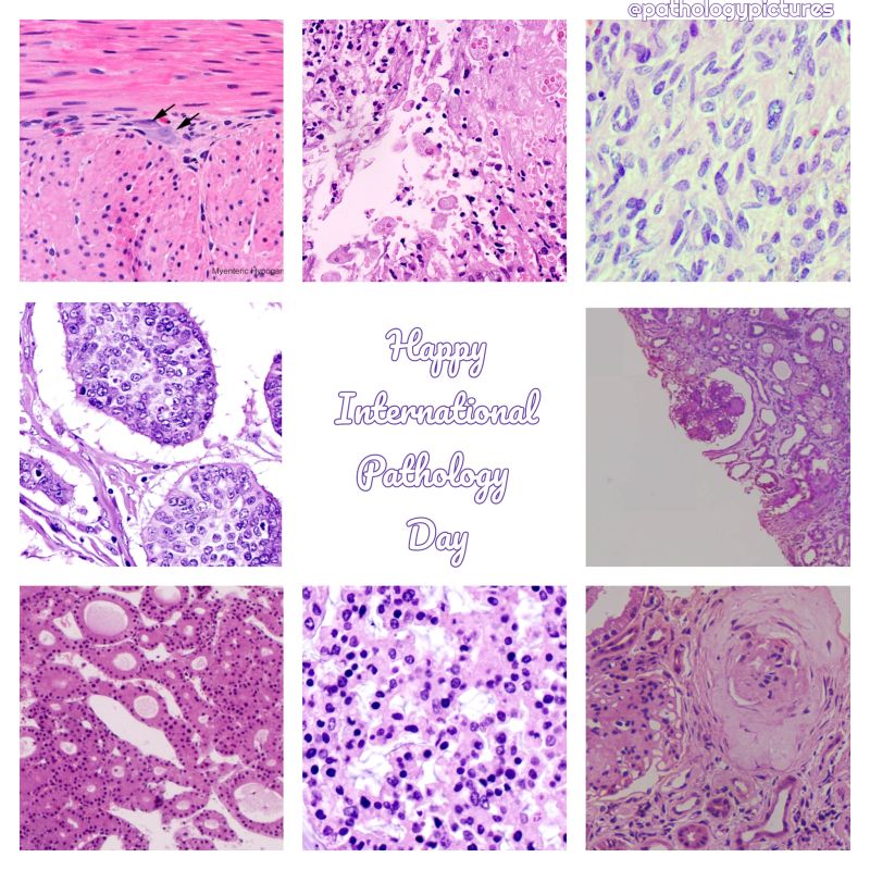 Dr. Sivaranjani Selvaraj on LinkedIn: #happyinternationalpathologyday Dr. Sivaranjani Selvaraj on LinkedIn: #happyinternationalpathologyday
