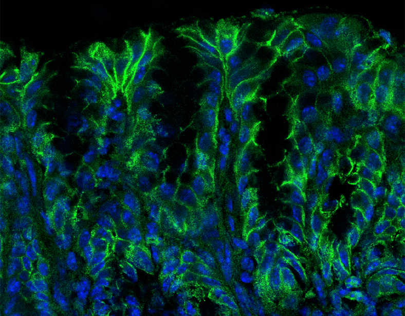 Rui Xu on LinkedIn: A semaphorin-plexin-Rasal1 signaling pathway ... Rui Xu on LinkedIn: A semaphorin-plexin-Rasal1 signaling pathway ...