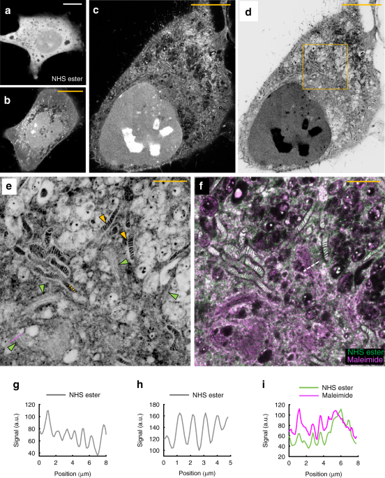 Volodymyr Nechyporuk-Zloy on LinkedIn: #imaging Volodymyr Nechyporuk-Zloy on LinkedIn: #imaging