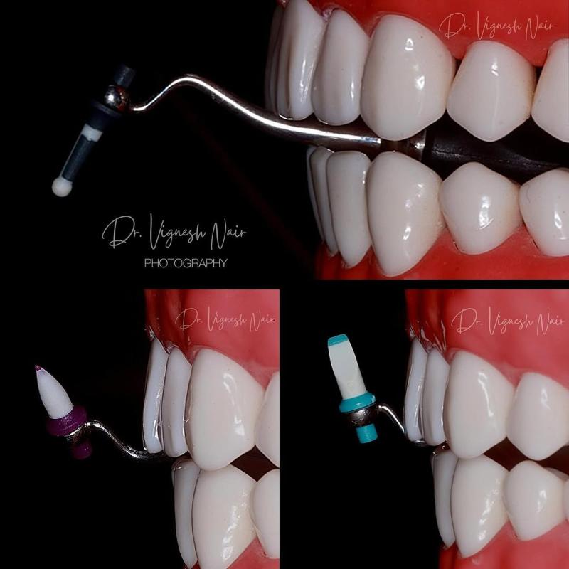 Vignesh R M.D.S on LinkedIn: Dr. Vignesh R, MDS 🇮🇳 | RESTORATIVE ... Vignesh R M.D.S on LinkedIn: Dr. Vignesh R, MDS 🇮🇳 | RESTORATIVE ...