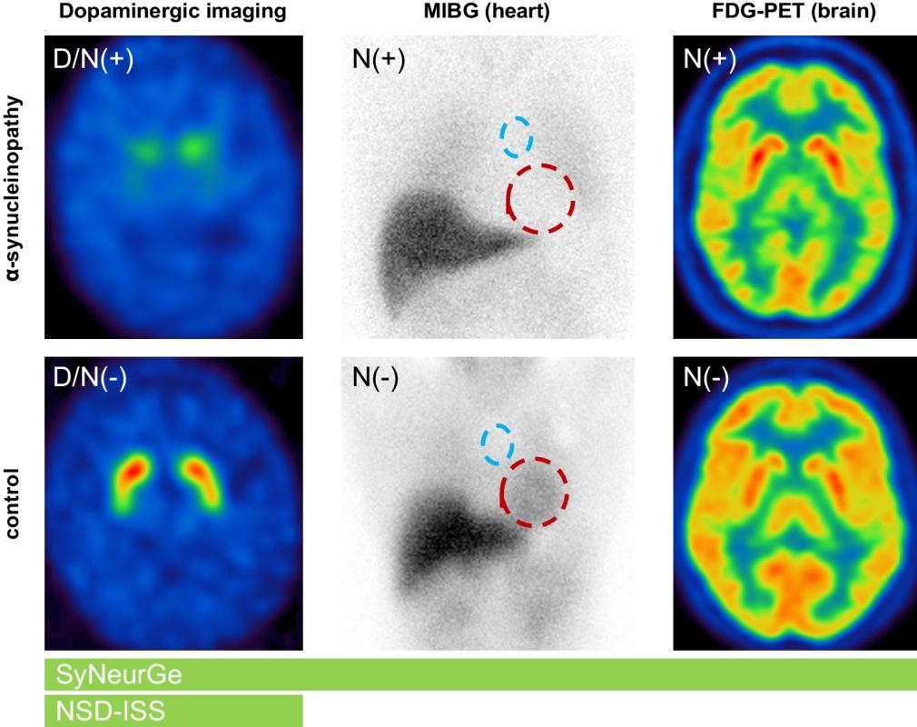Pablo Aguiar-Fernández on LinkedIn: Neuroimaging biomarkers in the ... Pablo Aguiar-Fernández on LinkedIn: Neuroimaging biomarkers in the ...