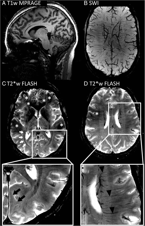 Andreas Sofroniou on LinkedIn: Ultrahigh field MRI in clinical ... Andreas Sofroniou on LinkedIn: Ultrahigh field MRI in clinical ...
