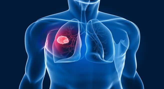 Dr Kirti Chadha on LinkedIn: Unlocking Early Detection: How Are ... Dr Kirti Chadha on LinkedIn: Unlocking Early Detection: How Are ...