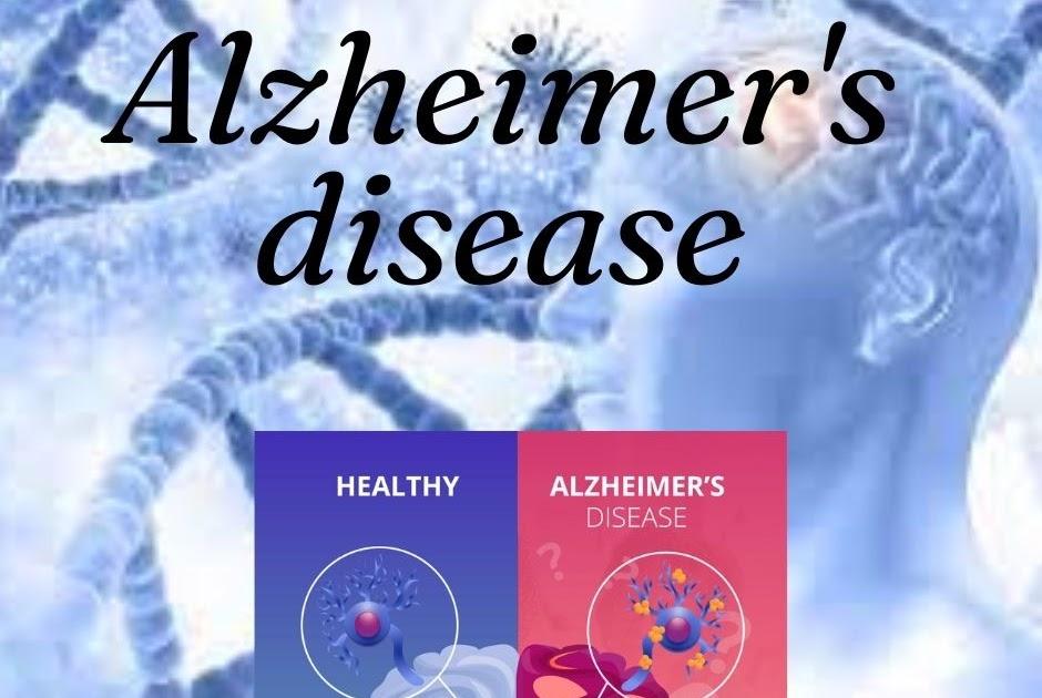 Dr. Shaista Sibghat on LinkedIn: Alzheimer's Disease Dr. Shaista Sibghat on LinkedIn: Alzheimer's Disease
