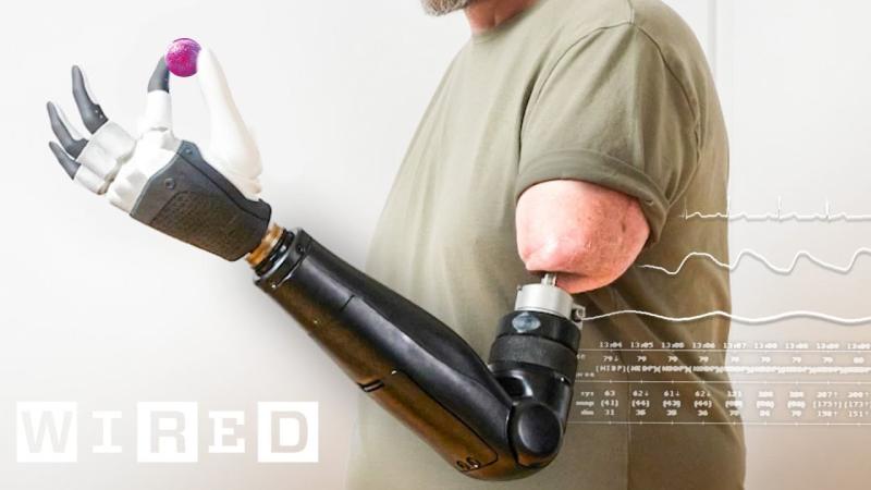 Max J. Ortiz Catalán on LinkedIn: How Mind-Controlled Bionic Arms Fuse ... Max J. Ortiz Catalán on LinkedIn: How Mind-Controlled Bionic Arms Fuse ...