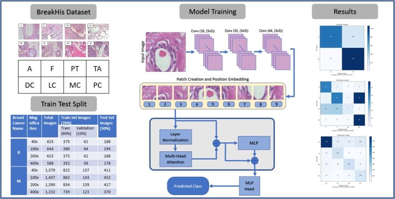 Dr. Zulfiqar Habib on LinkedIn: Magnification Independent Breast Cancer ... Dr. Zulfiqar Habib on LinkedIn: Magnification Independent Breast Cancer ...