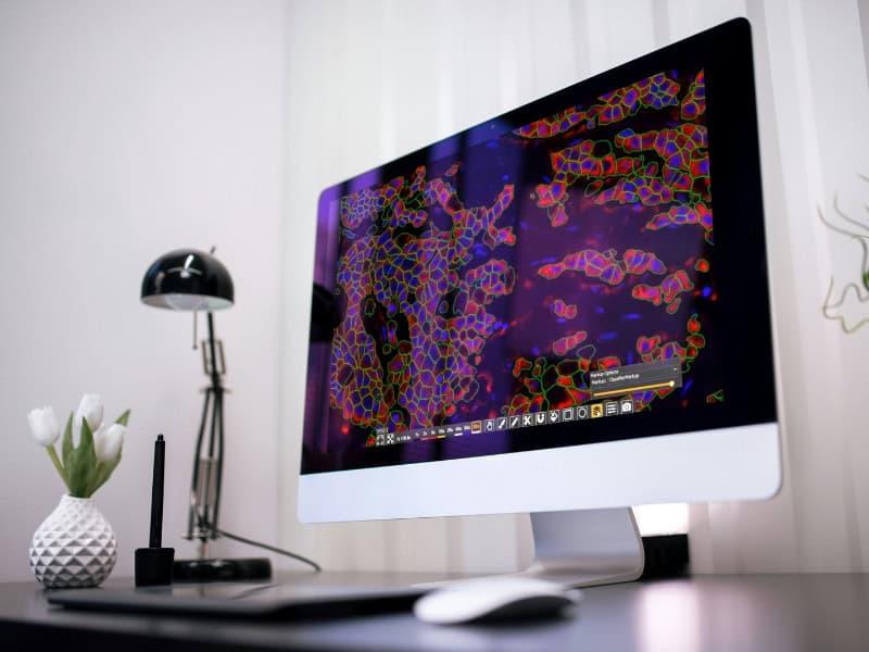 Pathology News on LinkedIn: Indica Labs Announces AI-Powered HALO ... Pathology News on LinkedIn: Indica Labs Announces AI-Powered HALO ...