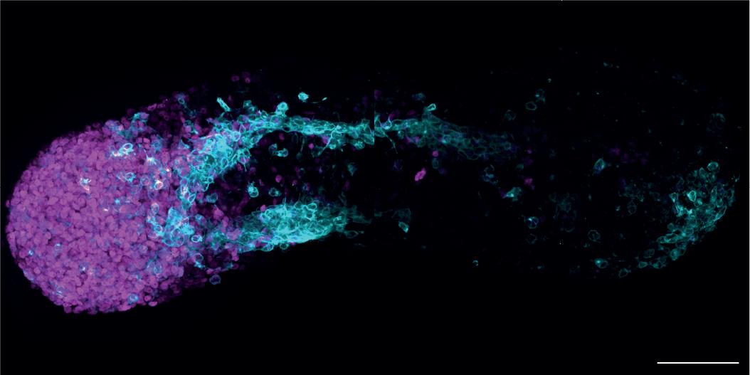 Medical Research Council on LinkedIn: Researchers develop pioneering ... Medical Research Council on LinkedIn: Researchers develop pioneering ...