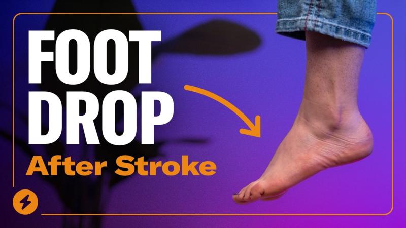 Post Stroke on LinkedIn: Why You Can’t Lift Your Foot After Stroke and ... Post Stroke on LinkedIn: Why You Can’t Lift Your Foot After Stroke and ...