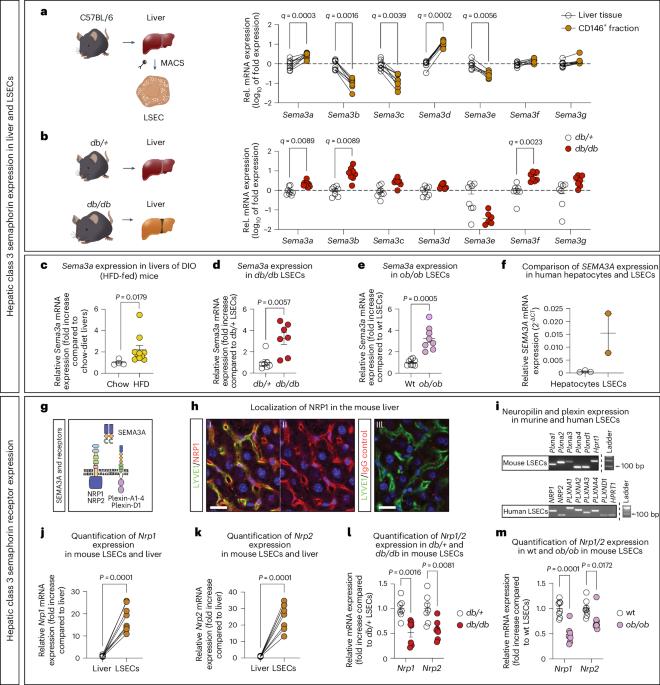 PamGene International B.V. on LinkedIn: Semaphorin-3A regulates liver ... PamGene International B.V. on LinkedIn: Semaphorin-3A regulates liver ...