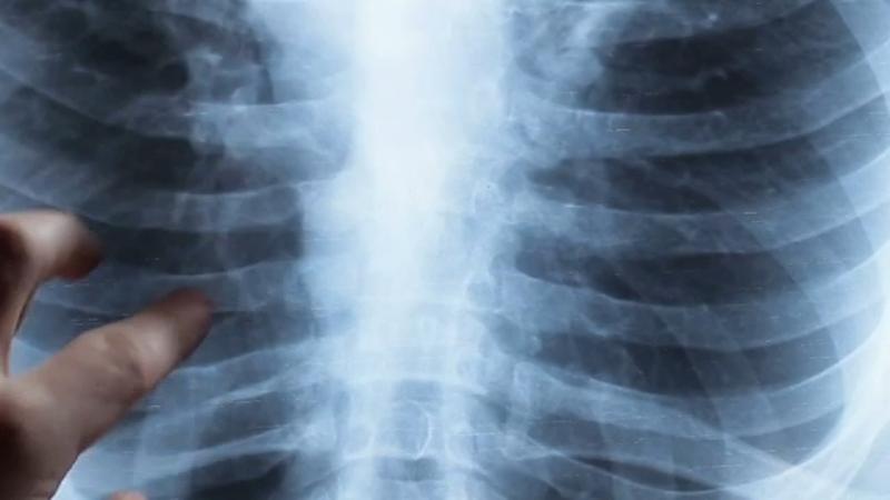 Anil Kaul on LinkedIn: Long Beach declares health emergency over ... Anil Kaul on LinkedIn: Long Beach declares health emergency over ...