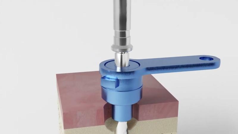 DIO Corporation on LinkedIn: Precision Redefined: Exploring the DIOnavi ... DIO Corporation on LinkedIn: Precision Redefined: Exploring the DIOnavi ...