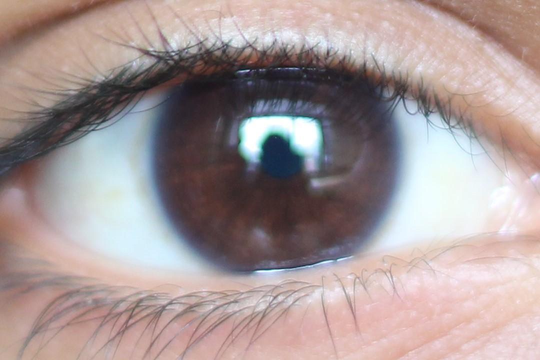 Mauzum Shamil on LinkedIn: Cataract Detection and Classification using ... Mauzum Shamil on LinkedIn: Cataract Detection and Classification using ...
