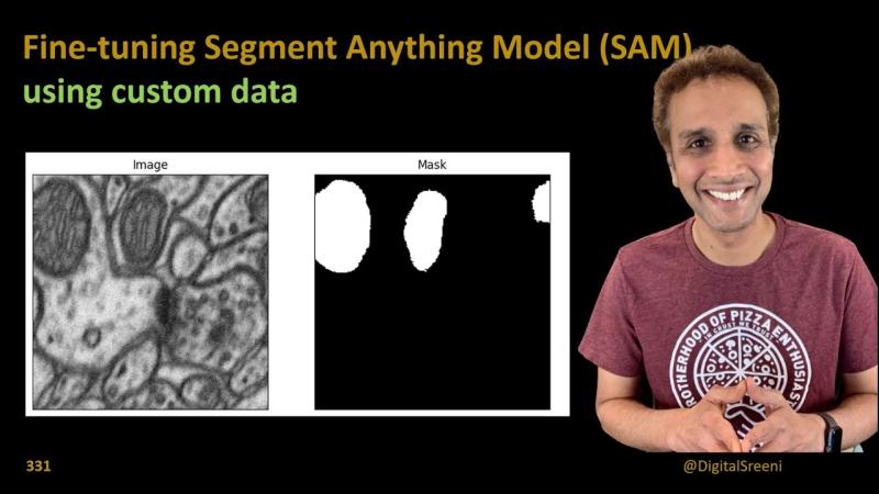 Sreenivas B. on LinkedIn: 331 - Fine-tune Segment Anything Model (SAM ... Sreenivas B. on LinkedIn: 331 - Fine-tune Segment Anything Model (SAM ...