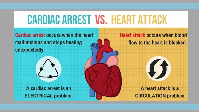 Dr. Shaista Sibghat on LinkedIn: Difference between cardiac arrest and ... Dr. Shaista Sibghat on LinkedIn: Difference between cardiac arrest and ...