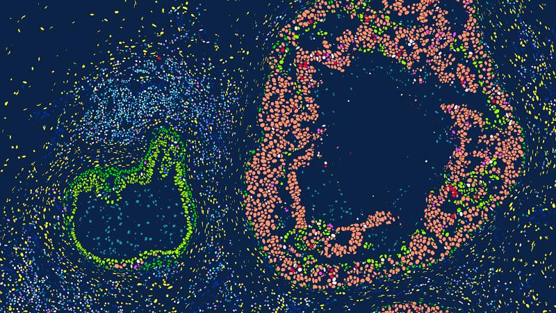 Christine Kao on LinkedIn: Behind the preprint: Combining single cell ... Christine Kao on LinkedIn: Behind the preprint: Combining single cell ...