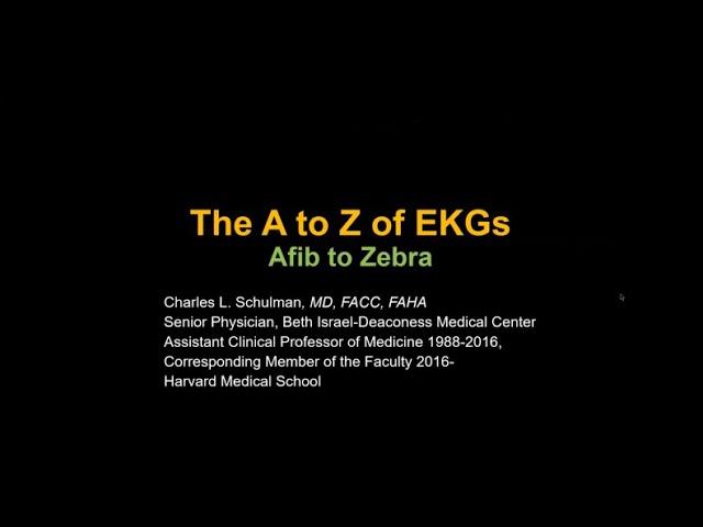 Basics of EKG / ECG | Shahnawaz Asif Raja Basics of EKG / ECG | Shahnawaz Asif Raja