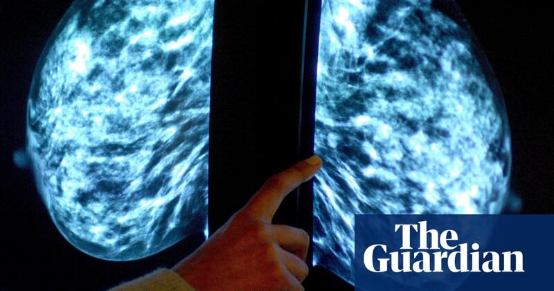 Cliff Lee on LinkedIn: NHS to launch world’s biggest trial of AI breast ... Cliff Lee on LinkedIn: NHS to launch world’s biggest trial of AI breast ...
