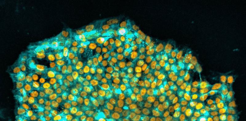 A 'memory wipe' for stem cells may be the key to better therapies | Ali ... A 'memory wipe' for stem cells may be the key to better therapies | Ali ...