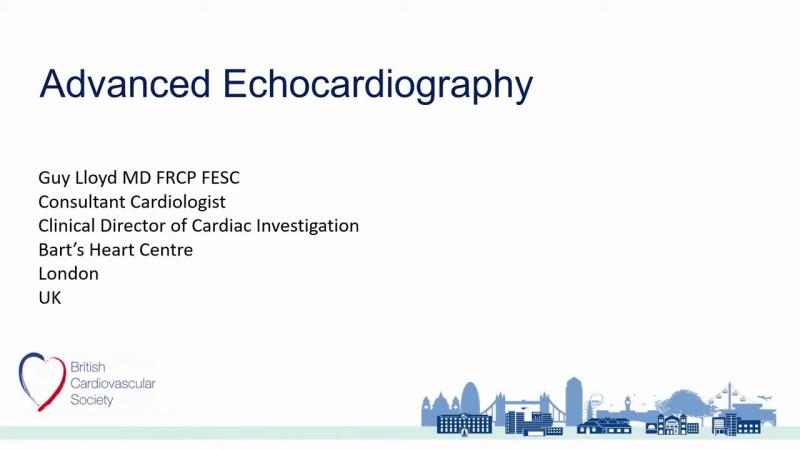 Learn Cardiology on LinkedIn: Advanced Echocardiography | Speckle ... Learn Cardiology on LinkedIn: Advanced Echocardiography | Speckle ...