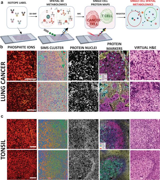 Shaima Kammoonah on LinkedIn: Single-cell spatial metabolomics with ... Shaima Kammoonah on LinkedIn: Single-cell spatial metabolomics with ...