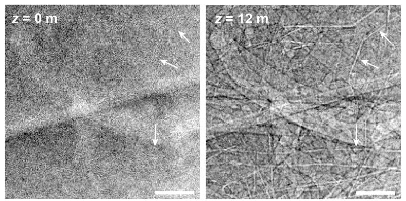 Phys.org on LinkedIn: Advanced imaging tech may be able to detect early ... Phys.org on LinkedIn: Advanced imaging tech may be able to detect early ...