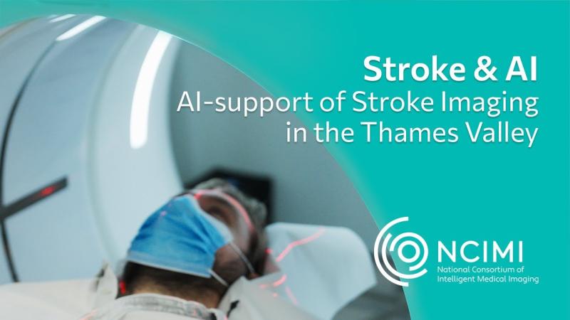Brainomix on LinkedIn: Stroke & AI: How the e-Stroke software is ... Brainomix on LinkedIn: Stroke & AI: How the e-Stroke software is ...