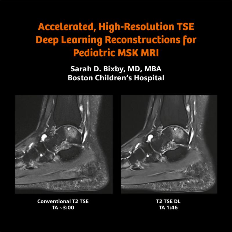 Phillip Uptmor on LinkedIn: Accelerated, High-Resolution TSE Deep ... Phillip Uptmor on LinkedIn: Accelerated, High-Resolution TSE Deep ...
