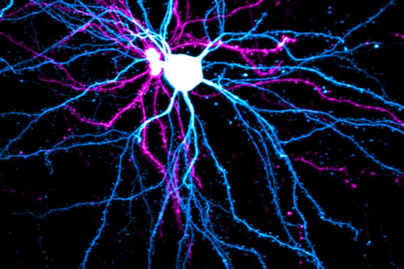 Sunalei on LinkedIn: Finding some stability in adaptable brains Sunalei on LinkedIn: Finding some stability in adaptable brains