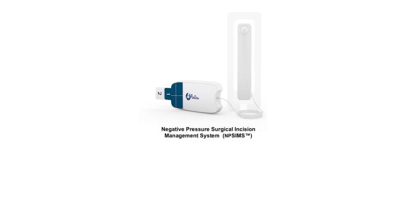Aatru Medical Announces FDA Clearance and Commercial Launch of the ... Aatru Medical Announces FDA Clearance and Commercial Launch of the ...