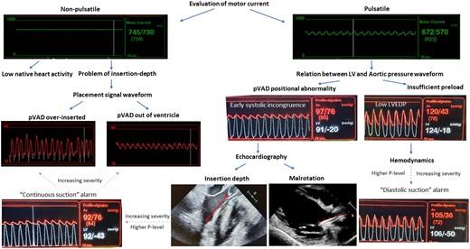 Short-term percutaneous mechanical circulatory support: no promise ... Short-term percutaneous mechanical circulatory support: no promise ...