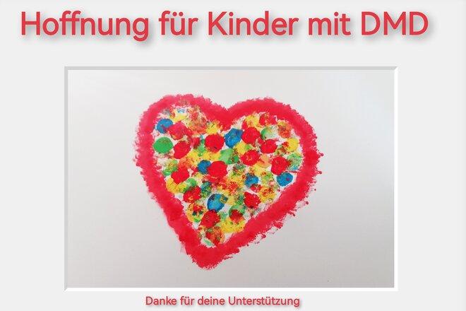 Hans Georg Bauer auf LinkedIn: Beschleunigte Zulassung von SRP-9001 für ... Hans Georg Bauer auf LinkedIn: Beschleunigte Zulassung von SRP-9001 für ...