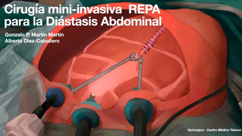Gonzalo P. Martin-Martin, PhD, FEBColoproctology, FRoboticsCS on ... Gonzalo P. Martin-Martin, PhD, FEBColoproctology, FRoboticsCS on ...