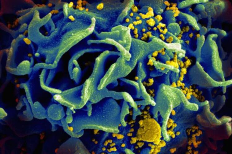 John Guanjing Zhang on LinkedIn: Global study: HIV patients face ... John Guanjing Zhang on LinkedIn: Global study: HIV patients face ...