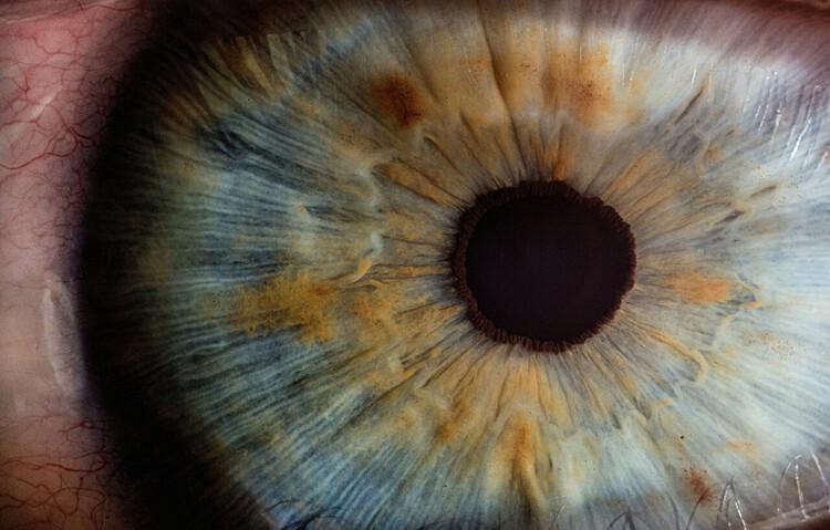 John Guanjing Zhang on LinkedIn: Early-stage trial finds stem cell ... John Guanjing Zhang on LinkedIn: Early-stage trial finds stem cell ...
