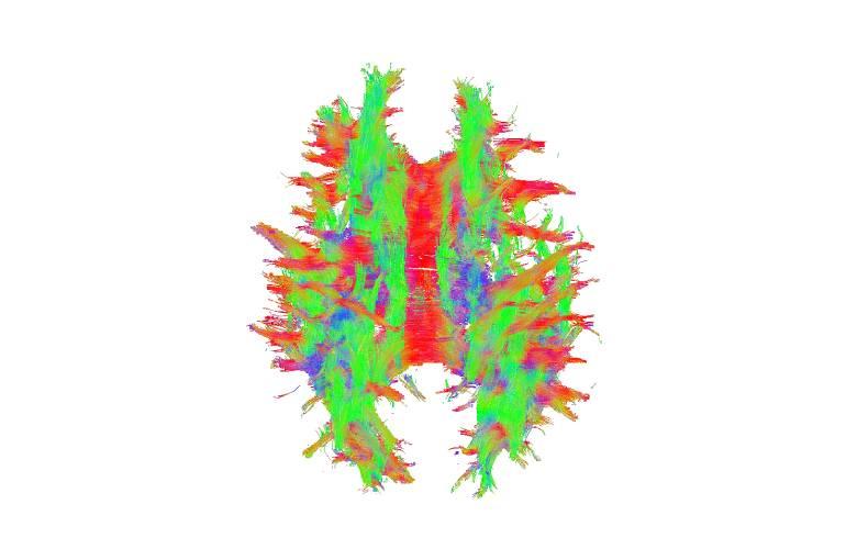 Medical Design & Outsourcing on LinkedIn: New brain imaging technique ... Medical Design & Outsourcing on LinkedIn: New brain imaging technique ...