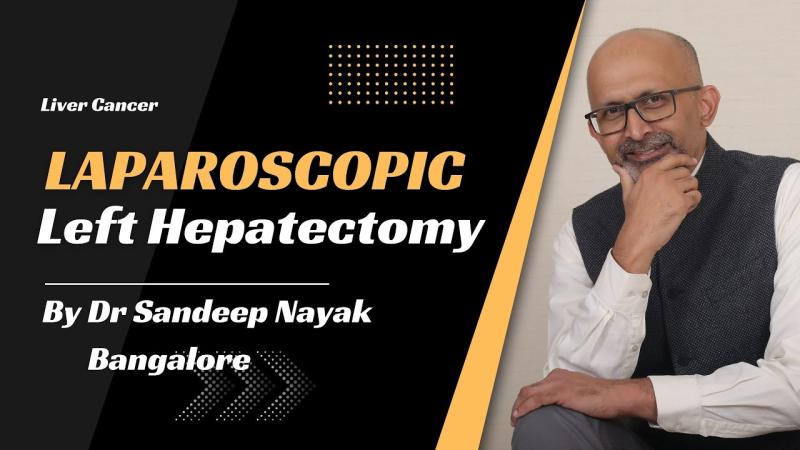 Laparoscopic Left Hepatectomy- Step by Step by Dr Sandeep Nayak & team ... Laparoscopic Left Hepatectomy- Step by Step by Dr Sandeep Nayak & team ...