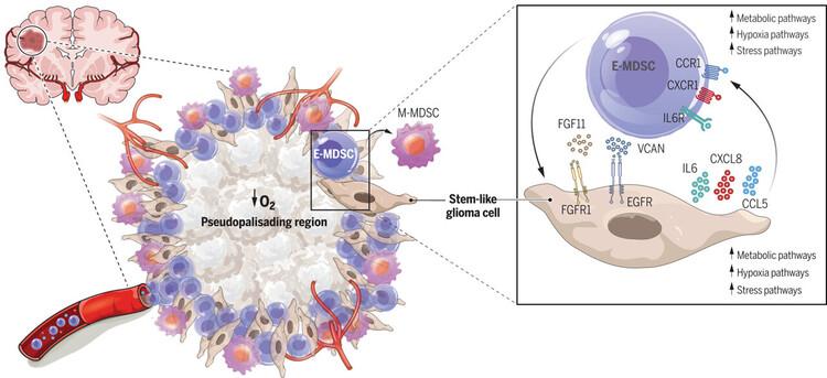 Co-located cell types help drive aggressive brain tumors, study finds ... Co-located cell types help drive aggressive brain tumors, study finds ...