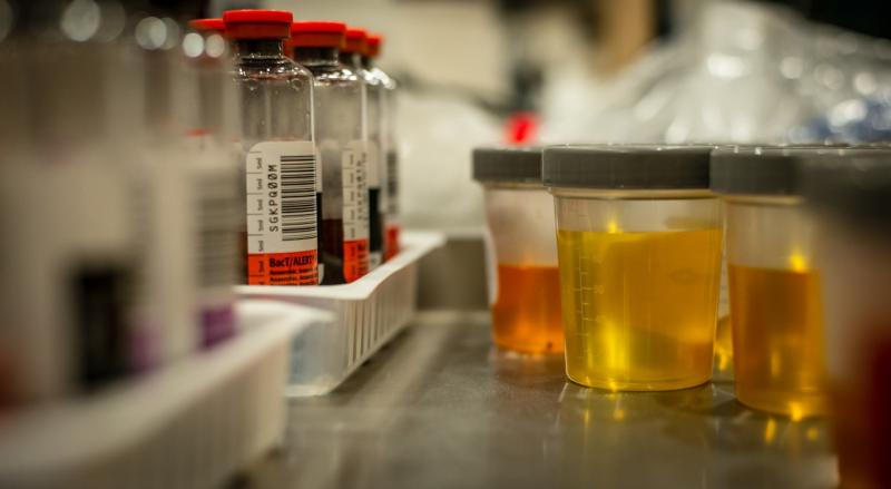 Scientists make breakthrough discovery while experimenting with urine ... Scientists make breakthrough discovery while experimenting with urine ...