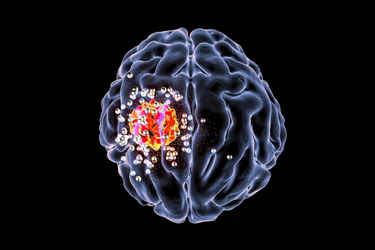 Noah R. on LinkedIn: Ultrasound Device Opens Blood-Brain Barrier to ... Noah R. on LinkedIn: Ultrasound Device Opens Blood-Brain Barrier to ...