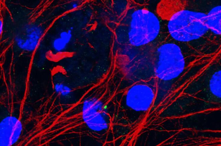 John Guanjing Zhang on LinkedIn: Discovery of cilia defects in ALS ... John Guanjing Zhang on LinkedIn: Discovery of cilia defects in ALS ...