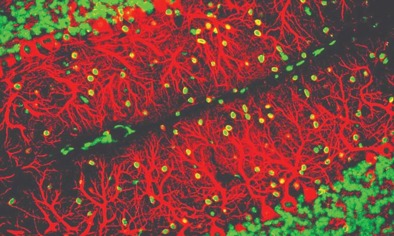Dr Bhavana Bhagat on LinkedIn: Neural networks: Human brain has ... Dr Bhavana Bhagat on LinkedIn: Neural networks: Human brain has ...