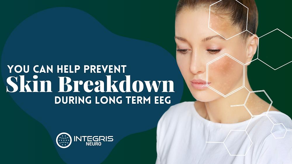 Alyssum G. on LinkedIn: You can help prevent skin breakdown! Alyssum G. on LinkedIn: You can help prevent skin breakdown!