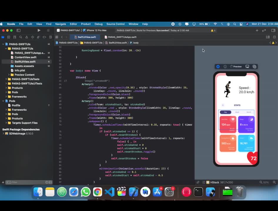Paras Chhugani on LinkedIn: #swiftui #iosdevelopment #iosdev #ios # ... Paras Chhugani on LinkedIn: #swiftui #iosdevelopment #iosdev #ios # ...