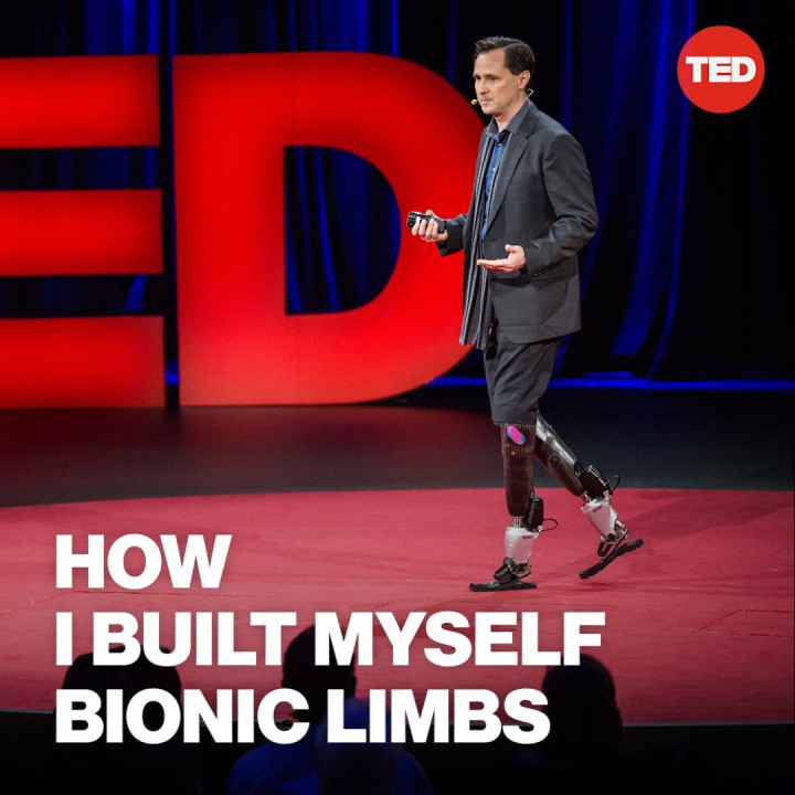 Smadar Kornfilt on LinkedIn: How I Built Myself Bionic Limbs Smadar Kornfilt on LinkedIn: How I Built Myself Bionic Limbs