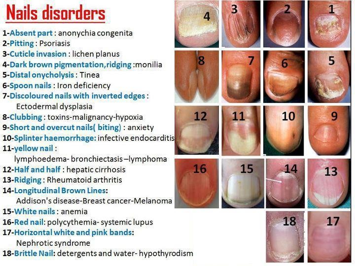 DIAGNOSTICS: part one... FINGERNAILS... DIAGNOSTICS: part one... FINGERNAILS...